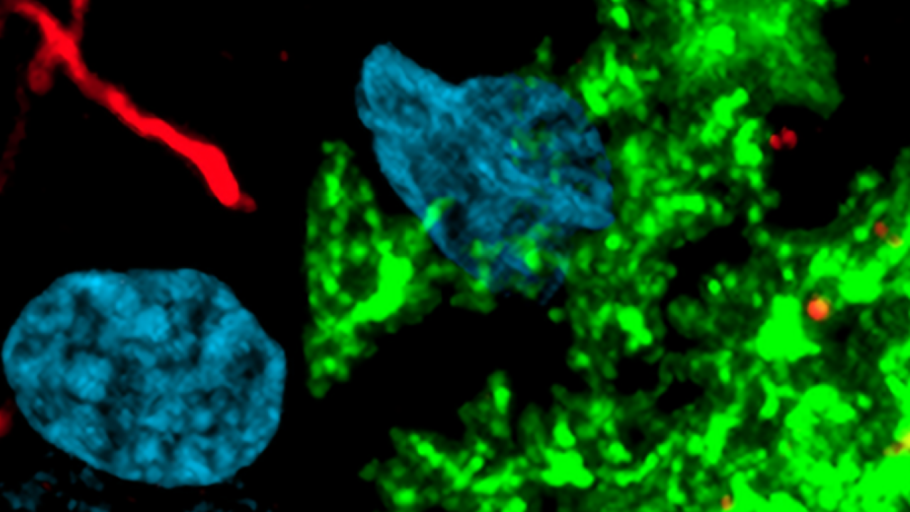 Barbara Chapman Neuroscience Award | UC Davis Center for Neuroscience