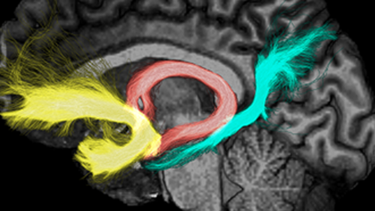 Research Topics | UC Davis Center for Neuroscience