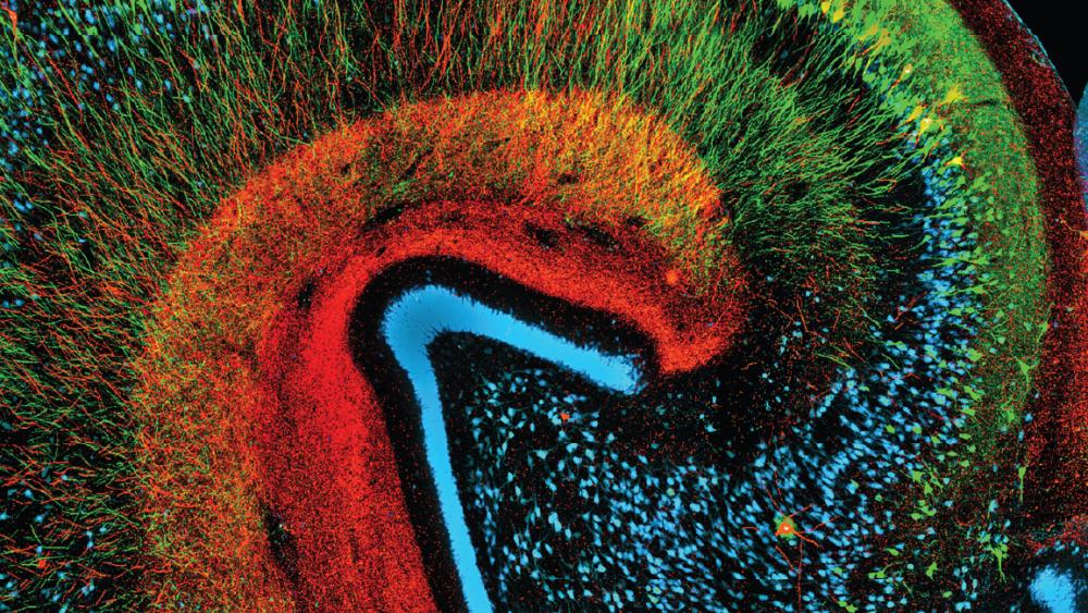 UC Davis images featured in NeuroArt Exhibition at the SMUD Museum of ...