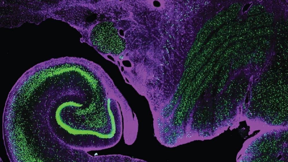 UC Davis images featured in NeuroArt Exhibition at the SMUD Museum of ...